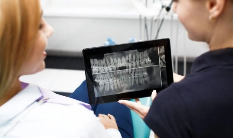 When Should Your Child Get Their First Dental X-Ray?